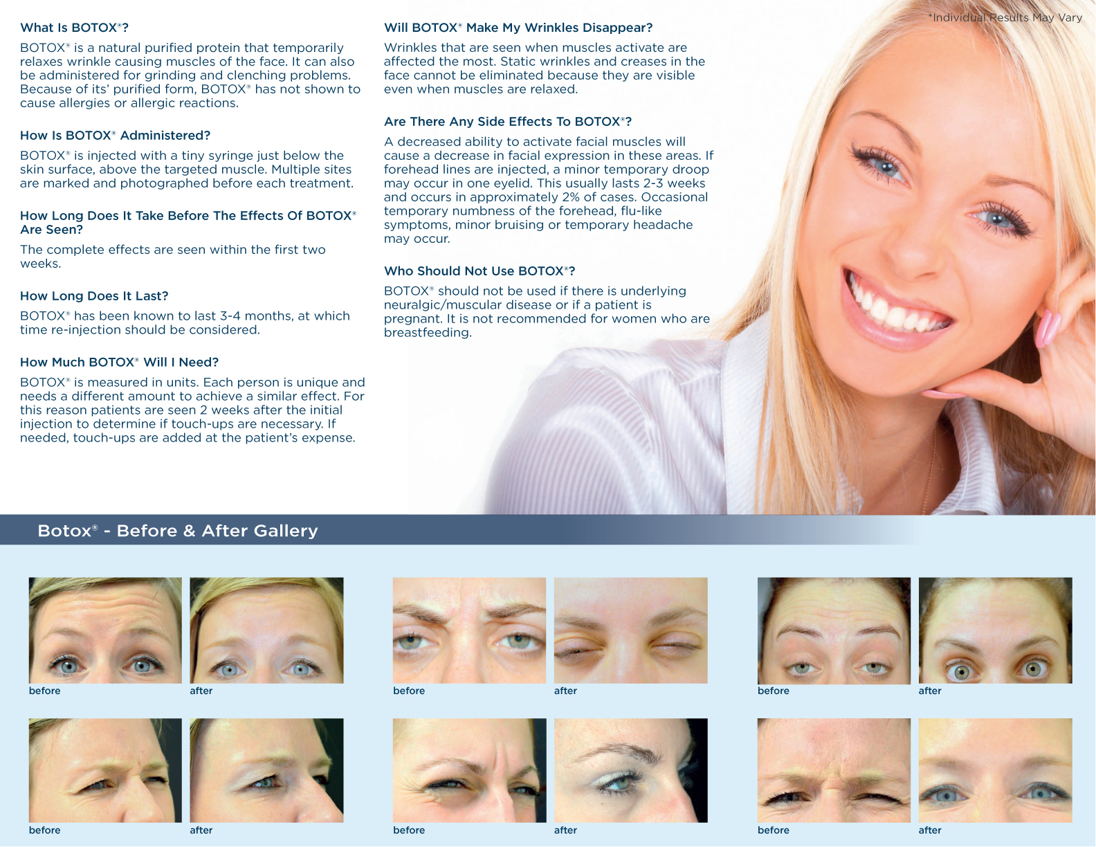 BOTOX® Brochures - Imprint Design and Printing